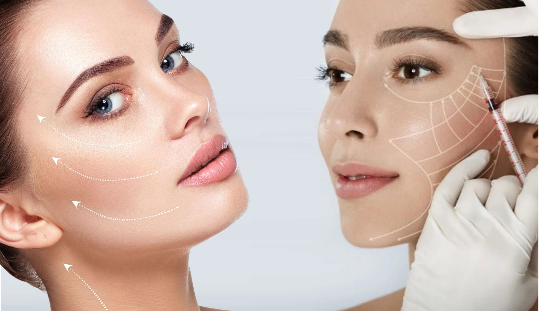 The Power of Biostimulators in Toronto | Medical Beauty Aesthetic Clinic